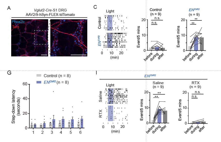 Neuron|复旦大学脑科学转化研究院倪金飞课题组揭示肠道内感觉和内脏痛的新机制：肠道内源性神经元和DRG感觉神经的对话